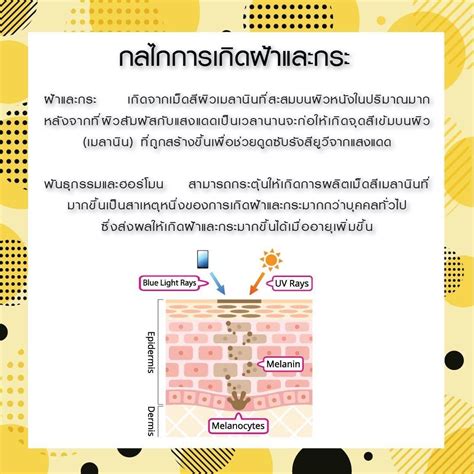 ☀️ฝ้า กระ จุดด่างดำ ปัญหาใหญ่ที่กวนใจสาวๆหลายคน จริงๆ แล้ว มันเกิดขึ้นได้ยังไง