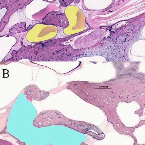 A Representative Horizontal Human Temporal Bone Section Showing Download Scientific Diagram