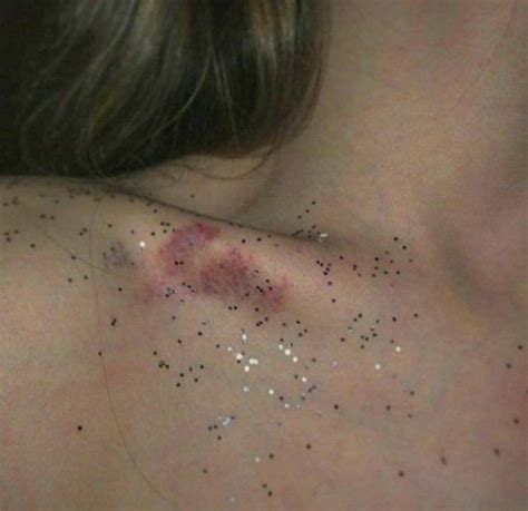 She Came Home With Bruises And Glitter Bubbba
