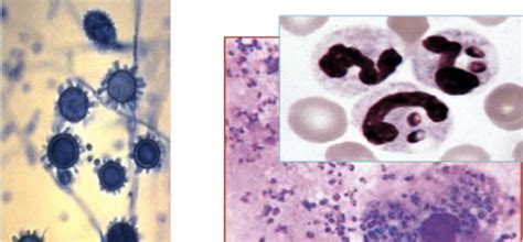 Microbiology Exam 4 Fungal Infections Flashcards Quizlet