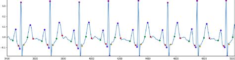 Figure 5 From Autonomous Myocardial Infarction Detection From