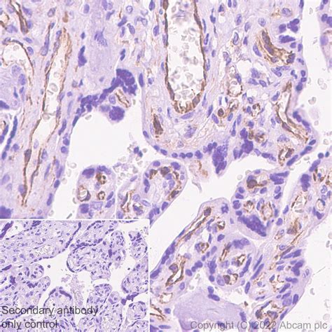 Anti Gpcr Gpr4 Antibody Epr27342 7 Ab307363 Abcam