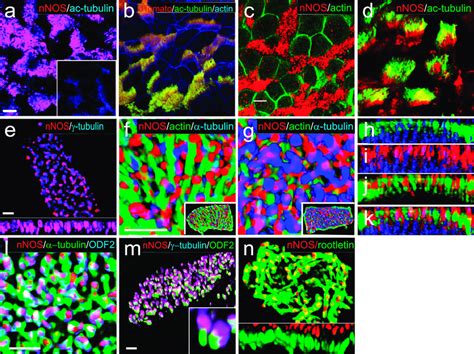 localization of nnos in the ciliated cells of trachea a