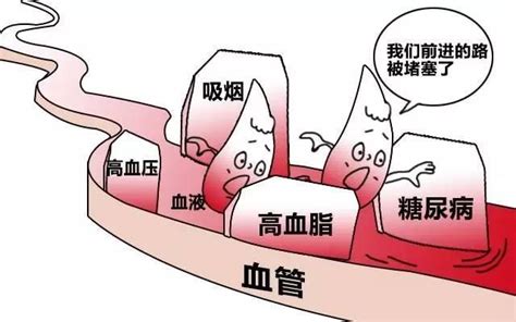 了解这6点，血脂就能控制好 知乎