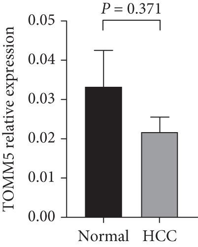 Qrt Pcr Validation In Hepatocellular Carcinoma Tissues N 39 A Download Scientific Diagram