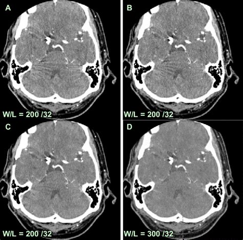 Comparison Between Algorithms A No Correction B Adaptive Data