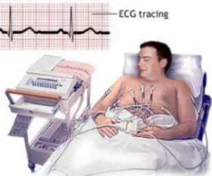 What Are The Types Of ECG Deep Medical Centre
