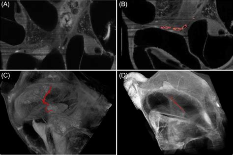 Vessel Tracking And Reconstruction From The Binary Mask Of The