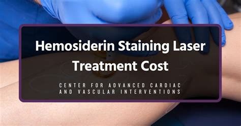 How Much Does Hemosiderin Staining Laser Treatment Cost