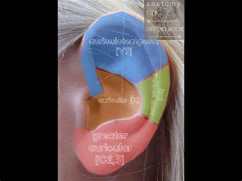 Auricular Block Emergency Medicine Ireland