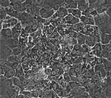 1 Human Foetal Hepatocytes 2 Days After Isolation Phase Contrast Download Scientific Diagram
