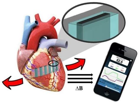 Schematic View Of The Wireless Strain Sensing System Monitoring The