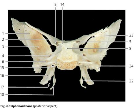 Sphenoid Bone Posterior Diagram Quizlet