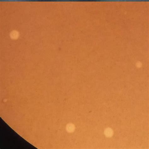 Picture Of Cryptococcus Neoformans In India Ink Download Scientific