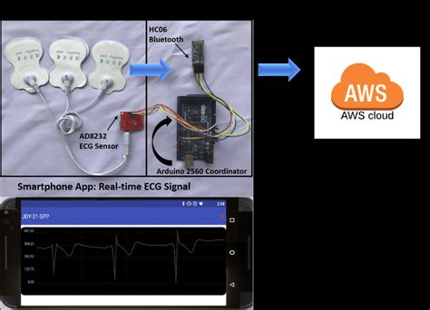 Real Time Ecg Signal Analysis And Classification Download Scientific