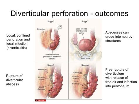 02 06 12 B A Gi Smorgasbord Common Gi Problems Part I