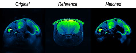 Histogram Matching Was Used To Simulate Other Contrasts And Increase Download Scientific