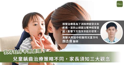 乳牙蛀牙為什麼需要根管治療？兒童出現齲齒必知三大觀念！ Heho健康