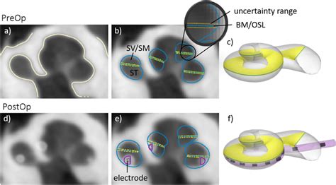 Image A Shows The Automatic Segmentation Of The Cochlea With A Download Scientific Diagram