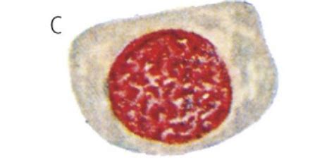 Eritropoiesi Definizione E Significato Medico Corriere Salute