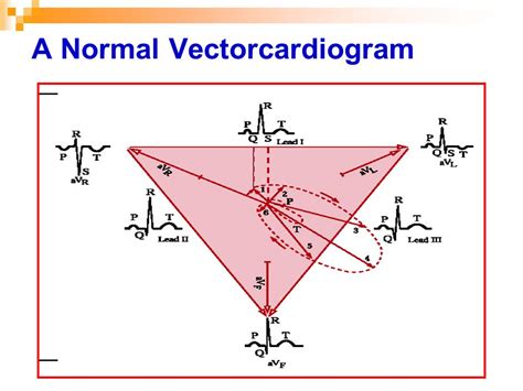 Vectorcardiogram At Vectorified Com Collection Of Vectorcardiogram Free For Personal Use
