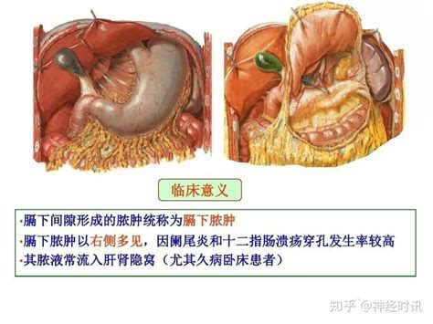 解剖腹膜及腹膜腔经典讲解汇总 知乎