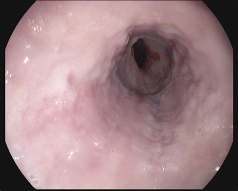 Simulametkvasir Vqa X1 · Datasets At Hugging Face