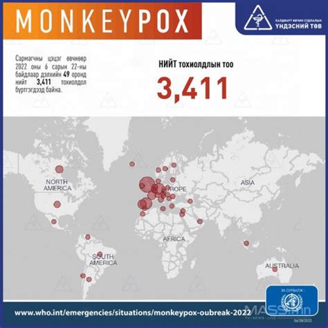 Дэлхийд сармагчны цэцэг өвчний нийт 3 411 тохиолдол бүртгэгдээд байна