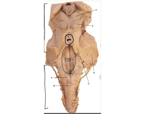 Midbrain Medulla Quiz
