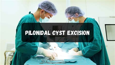 How To Prevent A Pilonidal Cyst From Coming Back