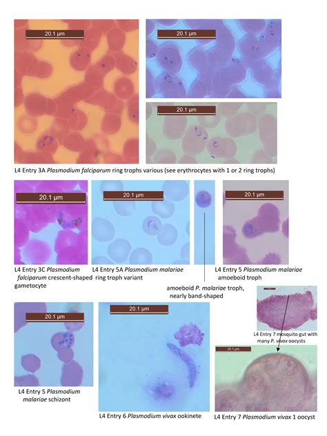 Laboratory 4 Apicomplexa 1 Plasmodium Parasitology Lab Manual