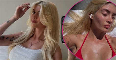 Sami Sheen Flaunts Bikini After Addressing Plastic Surgery Photos