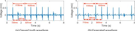 Figure 31 From Ecg Grained Cardiac Monitoring Using Uwb Signals Semantic Scholar