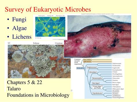 Ppt Survey Of Eukaryotic Microbes Powerpoint Presentation Free