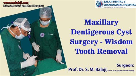 Maxillary Sinus Cyst Removal Surgery