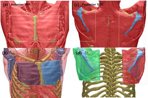 Setting Of Voivolume Of Interest And Result A Anterior View For