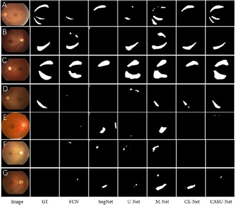 Visualization Examples Of Different Segmentation Methods The White