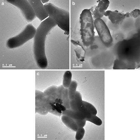 Tem Photographs Of A Denitrifying Bacteria B Denitrifying Bacteria