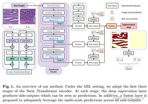 Transformer Based Multiple Instance Learning For Weakly Supervised