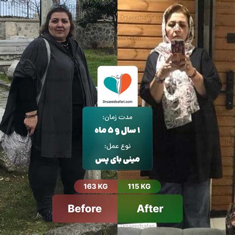 گالری وبسایت رسمی دکتر سعید صفری