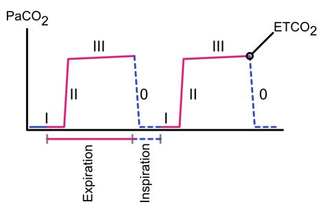 Capnography End Tidal Carbon Dioxide Measurement Etco2 During Cardiac Arrest
