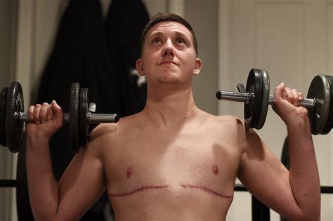 University Of Miami Encourages Students To Undergo Sex Change Surgery