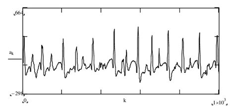The Eeg Signal During Epileptic Seizure Download Scientific Diagram