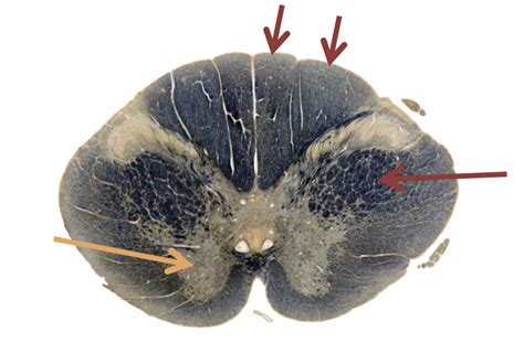 Neuroscience Cranial Nerves Pcom Diagram Quizlet