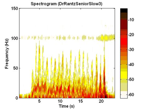 the spectrogram of the radar signal the unique signatures of the torso download scientific