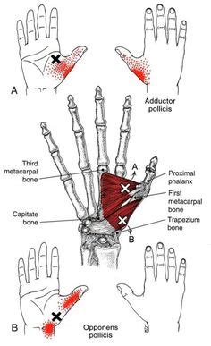 180 Trigger Points Ideas Trigger Points Trigger Point Therapy