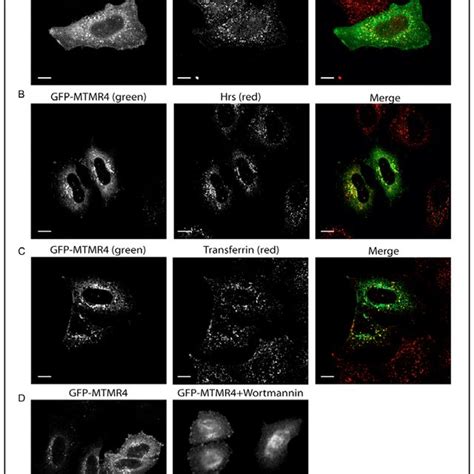 Mtmr4 Localizes To Endosomes Hela Cells Were Transfected With Download Scientific Diagram