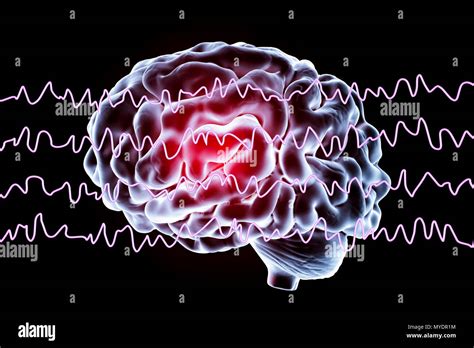 eeg brain waves