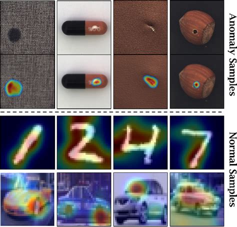 Figure 1 From Multiresolution Knowledge Distillation For Anomaly