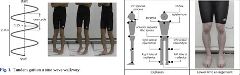 Tandem Gait Test